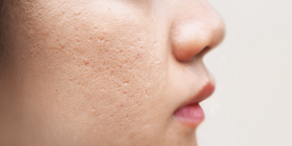 What Really Causes Scars? Discover the Truth Behind Your Skin's Healing ...