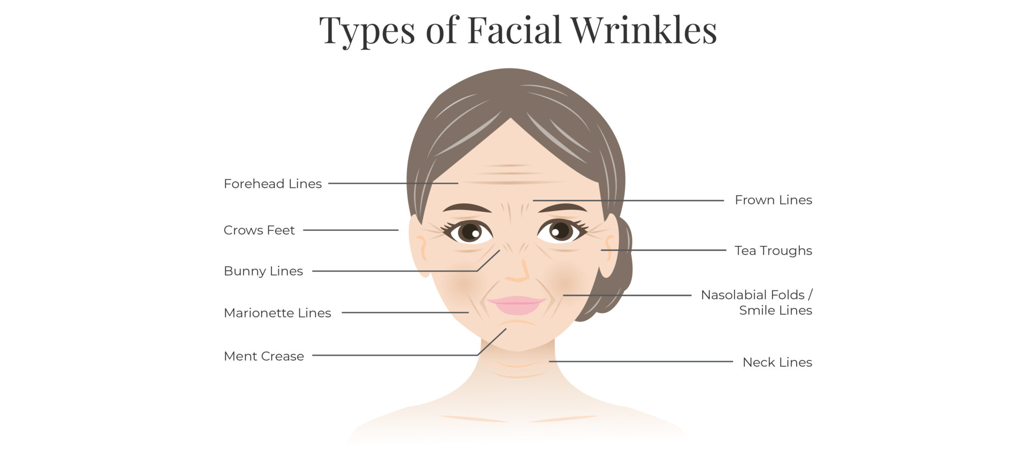 Wrinkles and Fine Lines Archives - CS Medical Aesthetics Clinic